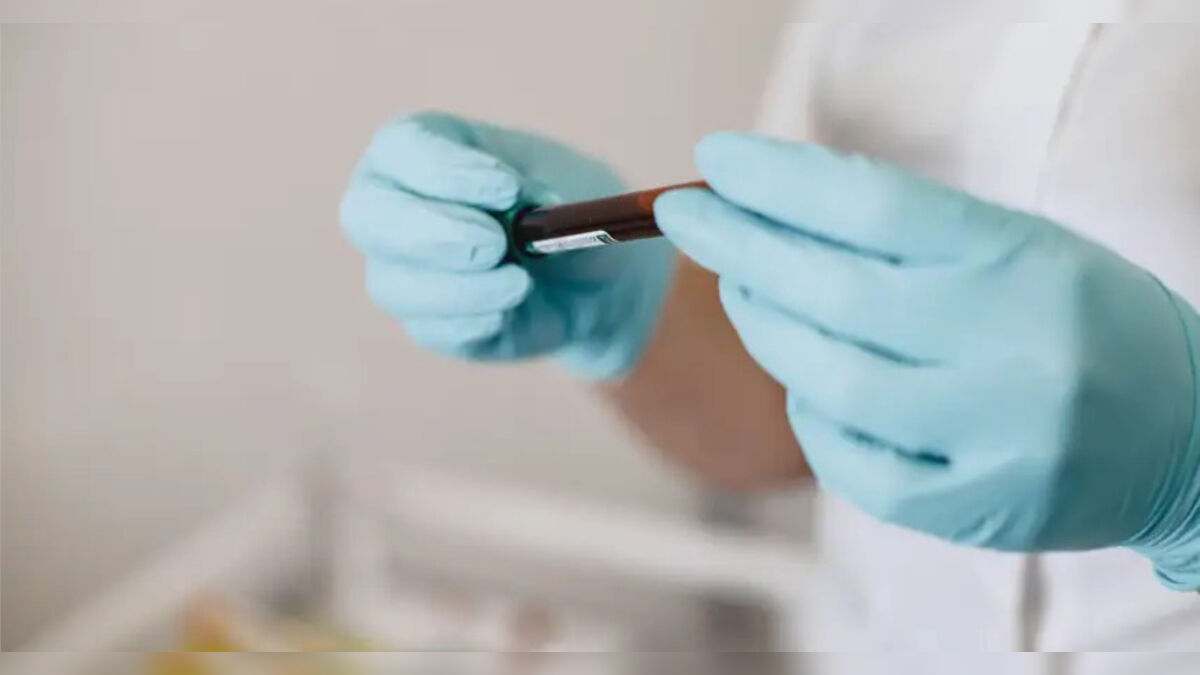 Hospital Octávio Lobo fará cadastro para técnico de laboratório • DOL