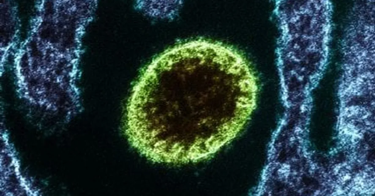 Vírus Nipah: veja principais sintomas, riscos e como se prevenir • DOL