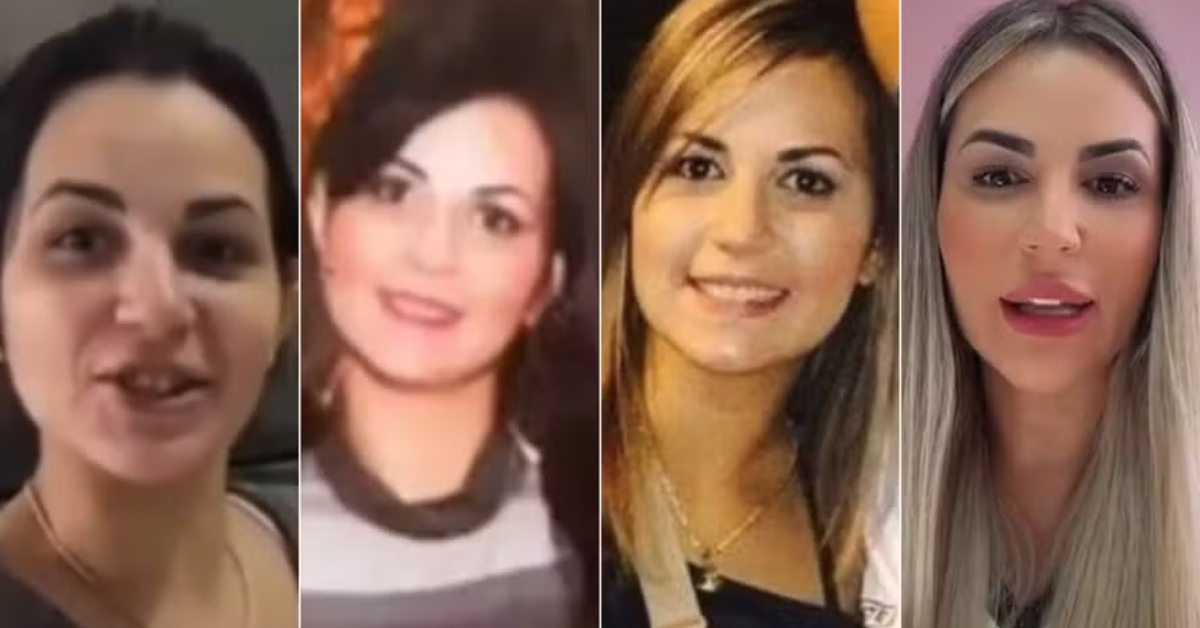 Antes e depois de Deolane Bezerra viraliza na internet • DOL